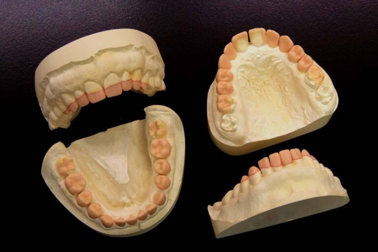 McKinney Orthodontist | Braces & Invisalign – Jensen Orthodontic Arts